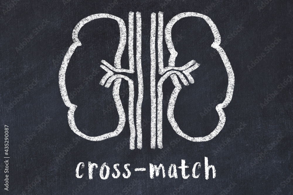 Chalk drawing of human kidneys and medical term cross-match. Concept of ...