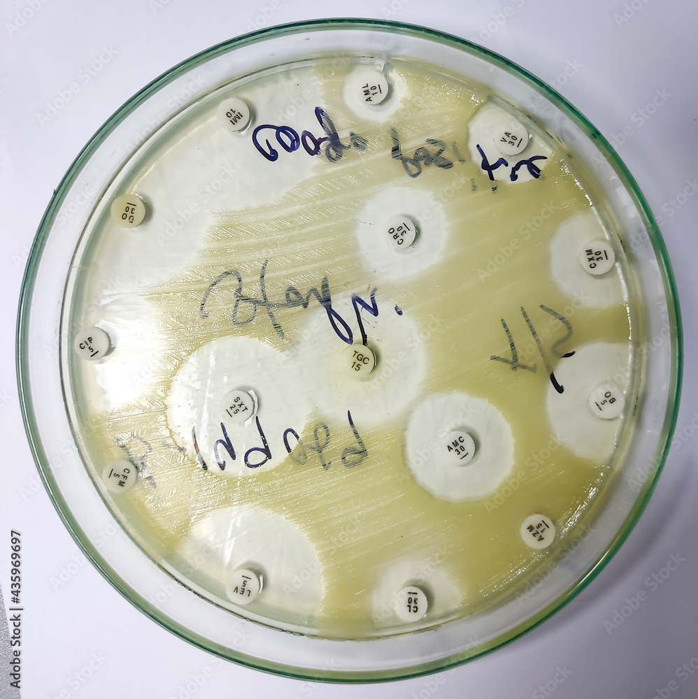 Antimicrobial susceptibility testing in culture plate. Drug sensitivity ...