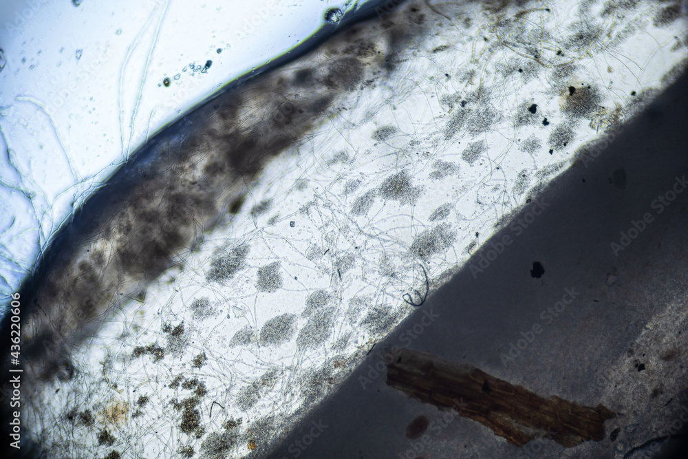 Kombucha tea macro close up under the light microscope, magnification ...
