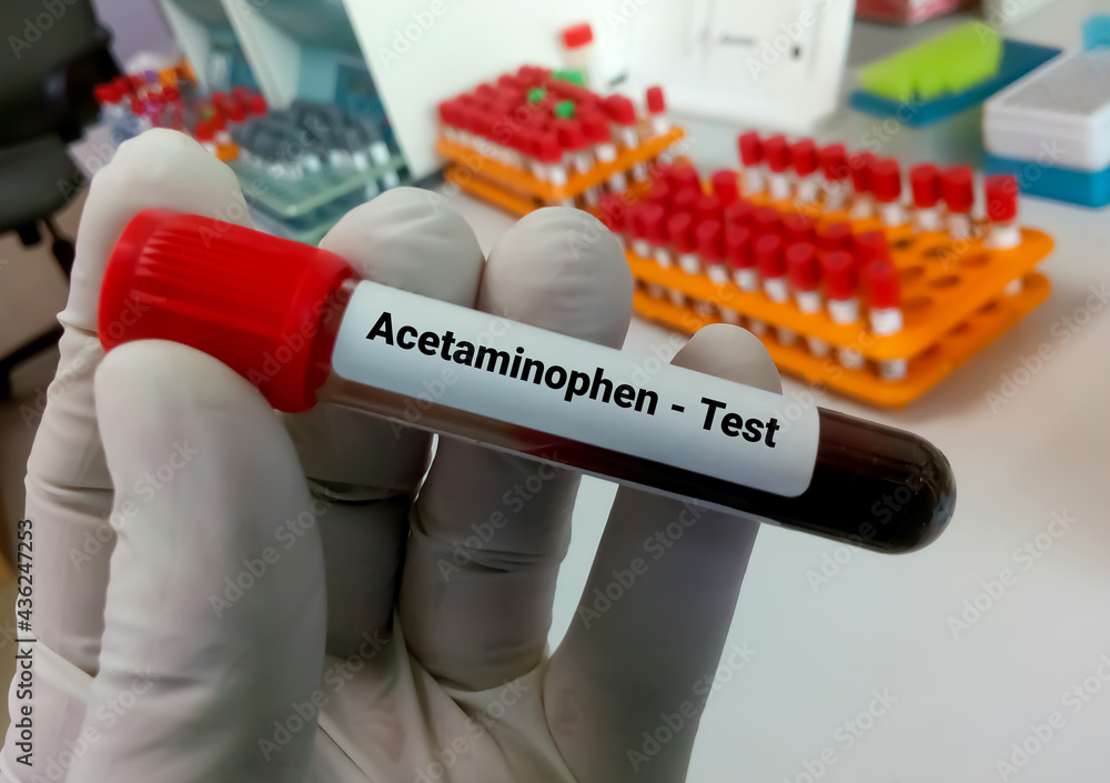 Scientist hold blood sample for Acetaminophen test. diagnosis of ...