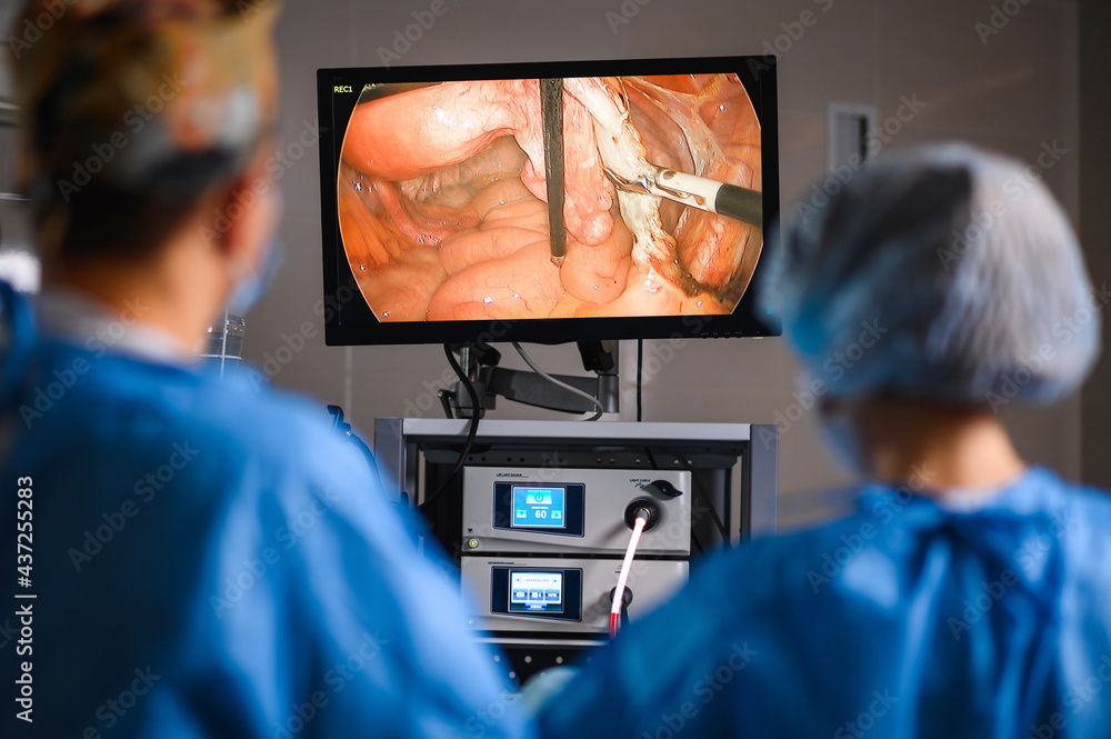 Monitor depicting endoscopic surgery. Endoscopic camera Stock Photo ...
