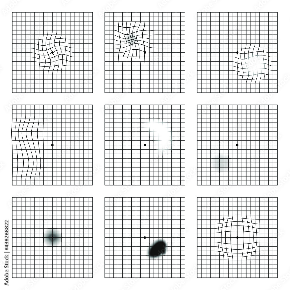 Image vectorielle Stock Amsler grid scotoma eye test. Oculist Vector ...