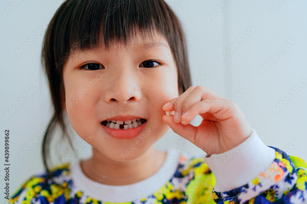 Little girl lost her first tooth Stock Photo | Adobe Stock