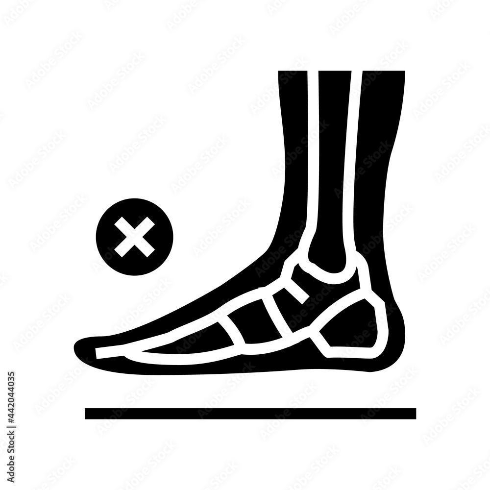 bone flat feet glyph icon vector. bone flat feet sign. isolated contour ...