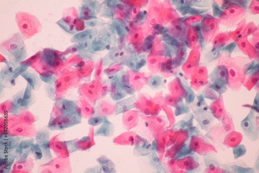 Normal squamous epithelial cells of cervical human view in microscopy ...