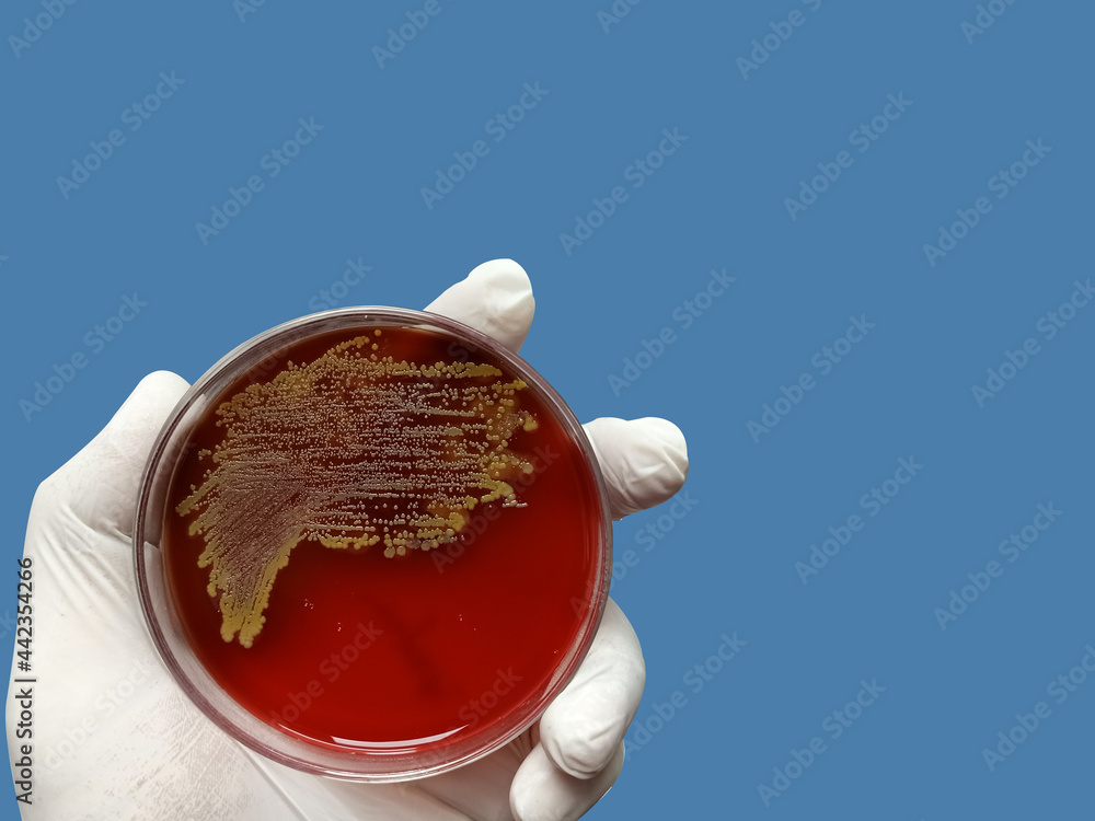 Biochemist of Lab Technologist holds Bacteria culture growth on ...