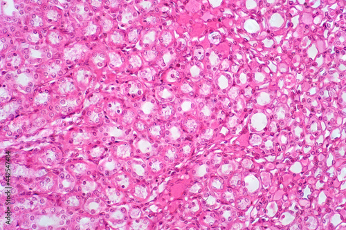 Histology of human kidney tissue under light microscope view for ...