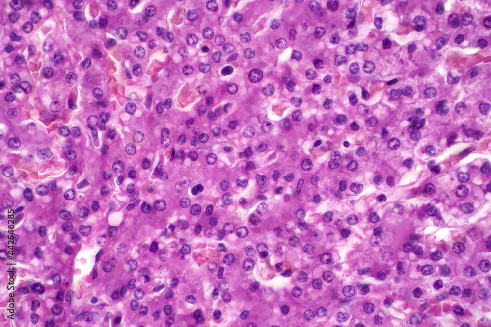 Hepatocyte is cell of the main parenchymal tissue of the liver under ...