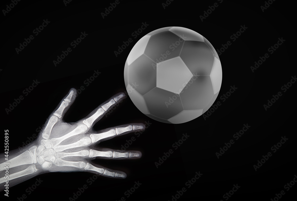 Golakeeper player's health concept - X-ray normal human's foot with ...