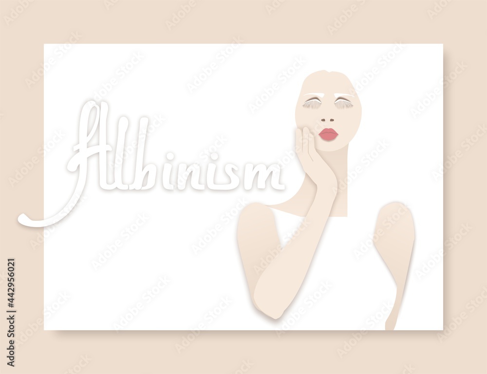 Woman with white hair and pale skin. Problems of albinism mutation in ...
