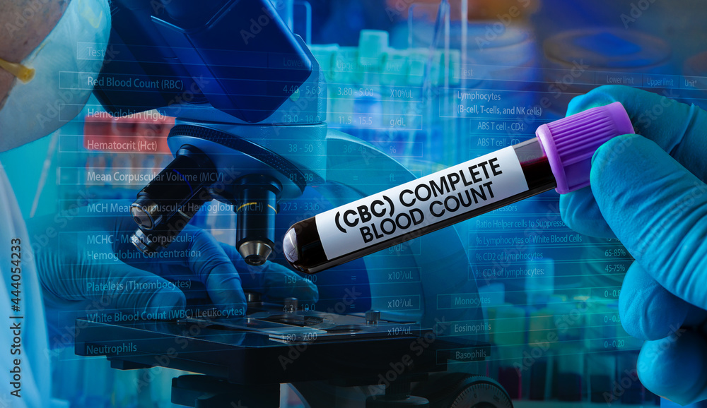 Foto de Stock Blood sample for CBC Complete Blood Count analysis tests ...