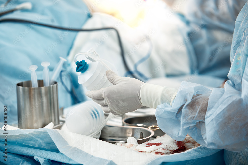 Mamoplasty, breast reconstruction, the surgeon's hands place an ...