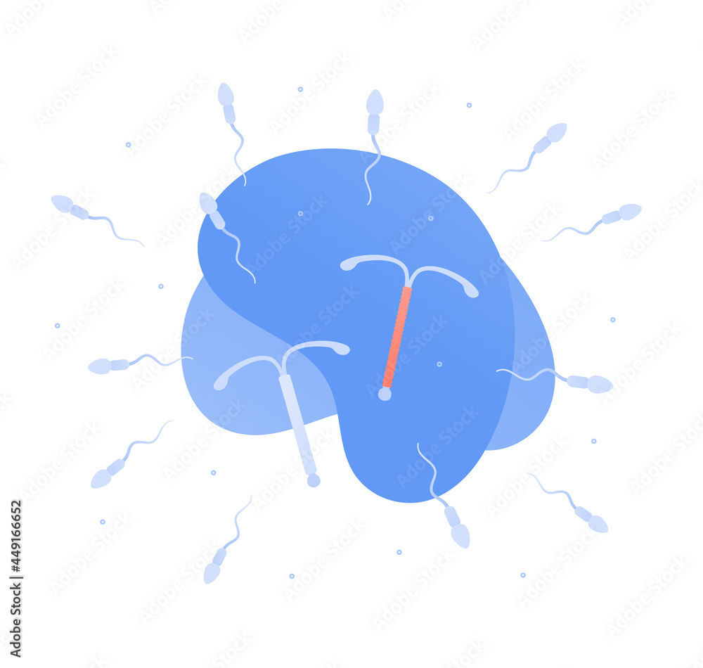 Vetor Contraception method concept. Vector flat color illustration ...
