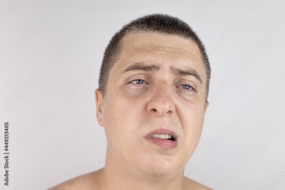 Foto de Stock A man with sweating on his face is looking at the camera ...