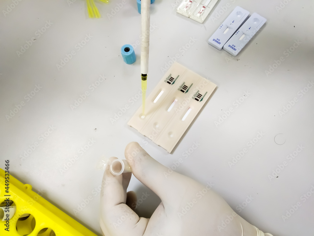 Rapid test cassettes for Dengue Antigen NS1Ag test at medical ...