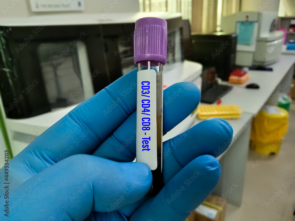 Blood sample tube for Flow Cytometry, CD3/CD4/CD8, Regulatory T cells ...