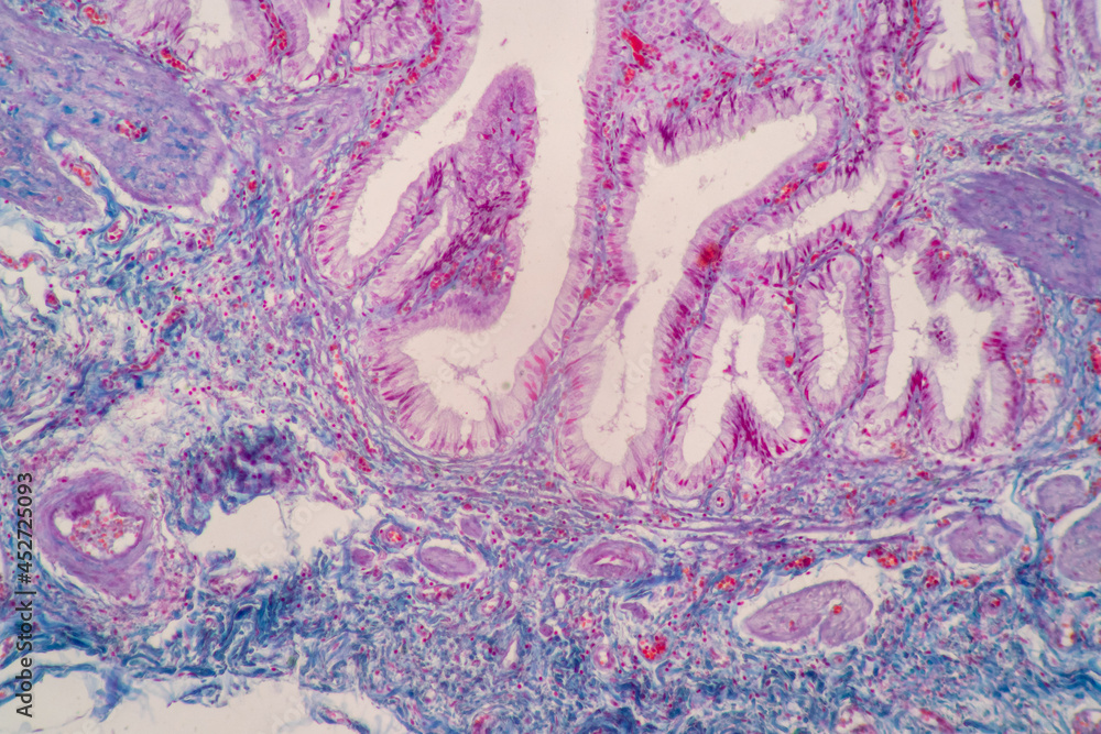 Characteristics of Columnar epithellum cell (Cell structure) of human ...