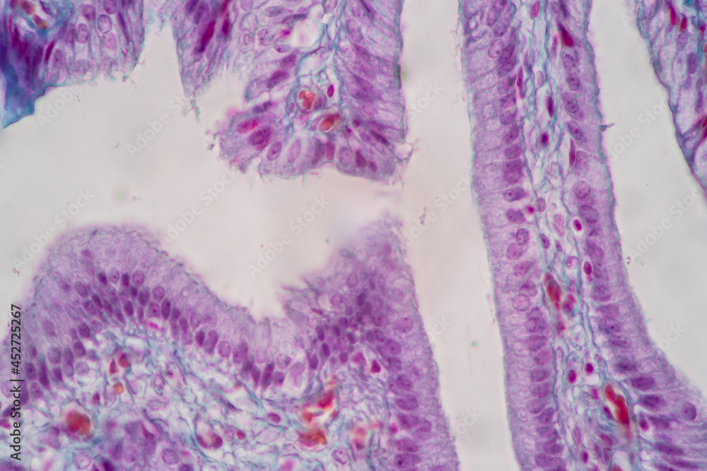 Characteristics of Columnar epithellum cell (Cell structure) of human ...