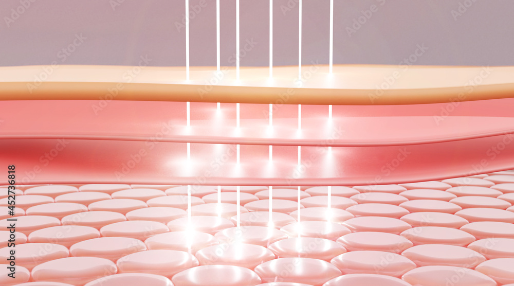 laser or serum vitamin through the skin layer for repair wrinkles and ...