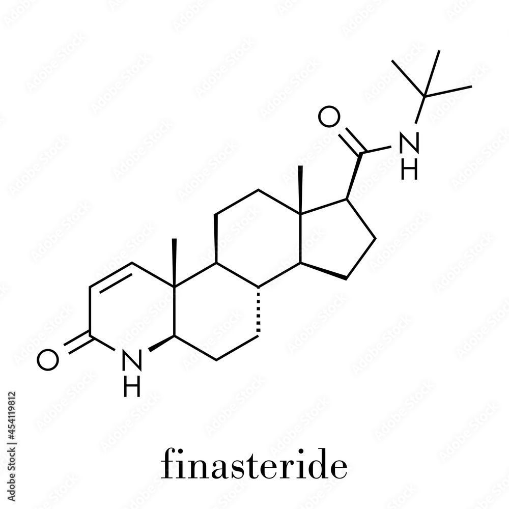 Finasteride male pattern baldness drug molecule. Also used in benign ...