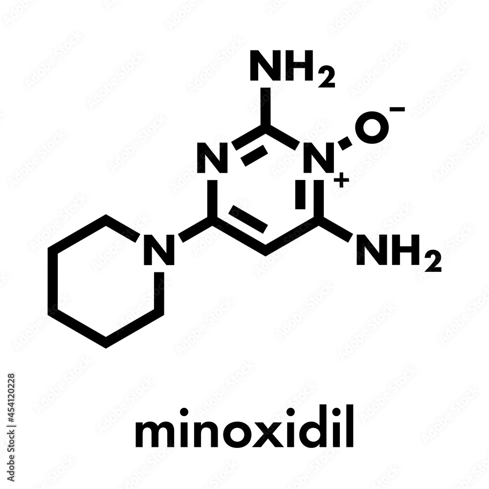 Minoxidil male pattern baldness (androgenic alopecia) drug molecule ...