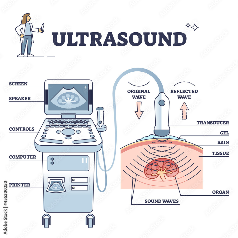 Ultrasound patient analysis process and equipment explanation outline ...