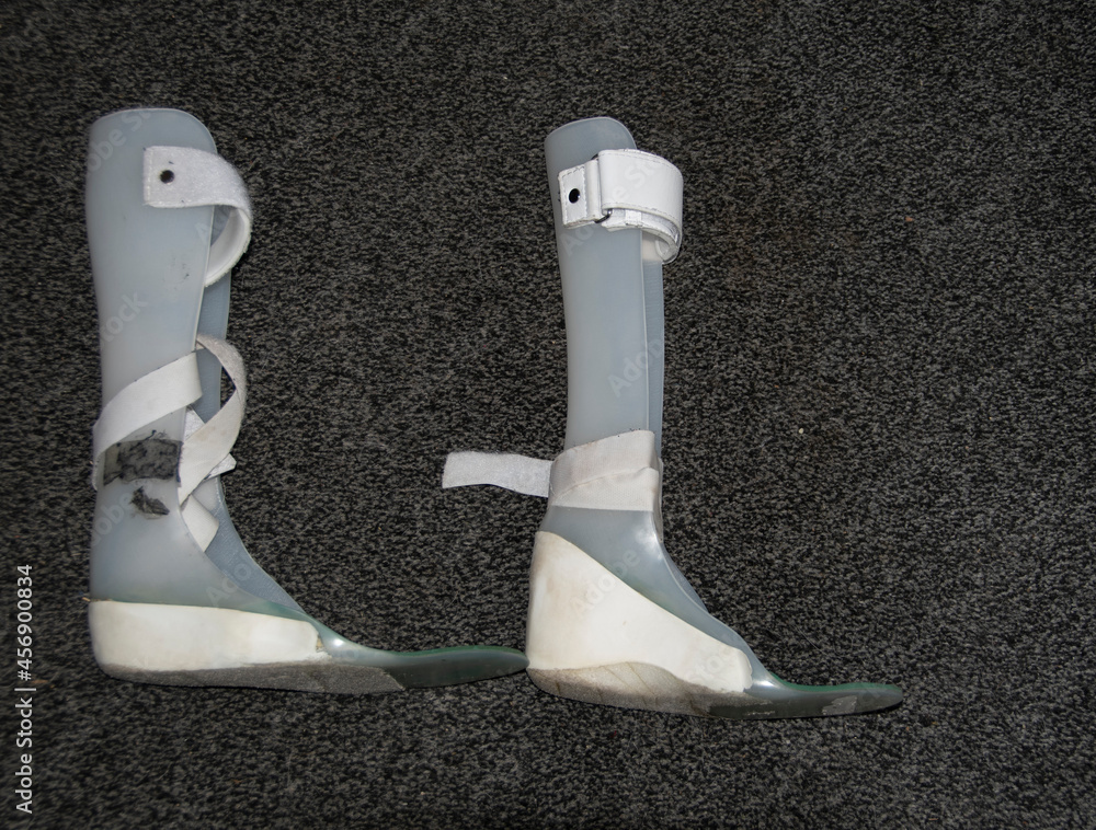 Foto de Stock One leg is then the other. measure leg length difference ...