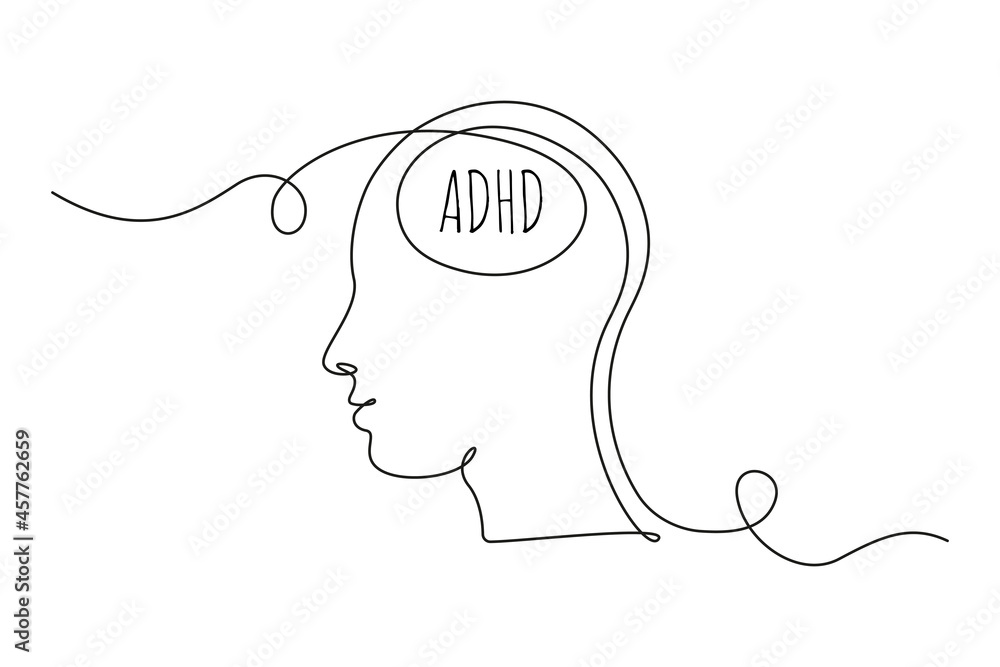 ADHD concept with man head. One continuous line drawing of messy ...