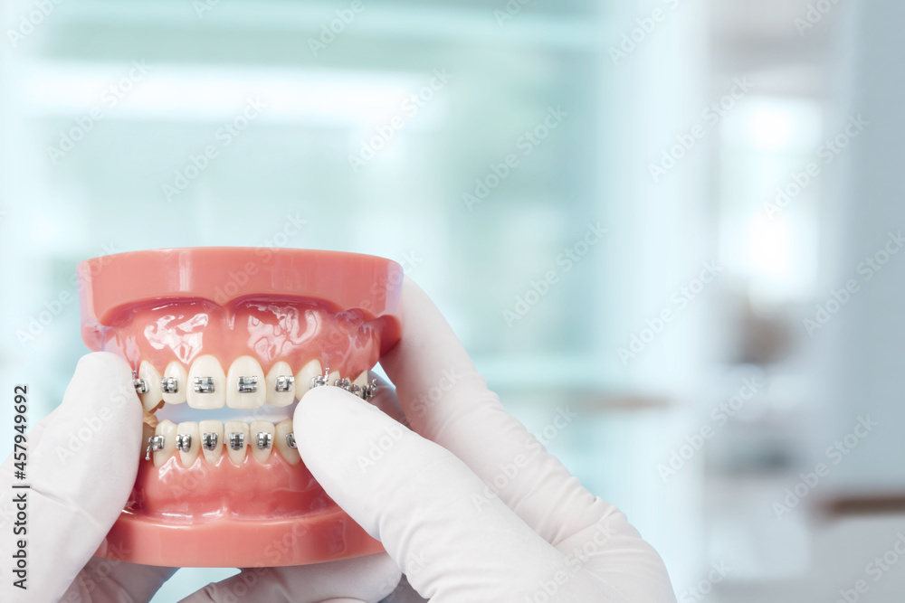 orthodontic model and dentist tool - demonstration teeth model of ...