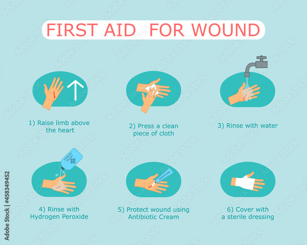 First aid treatment for wound on skin. Emergency situation, bleeding ...