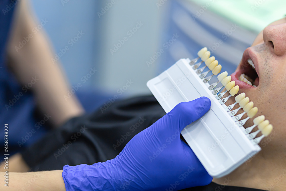 Choice, selection teeth color of special scale. Dentist select shade of ...