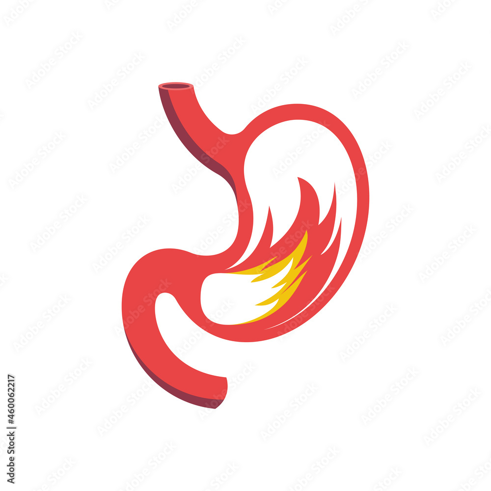 Heartburn flat icon. Fire in stomach. Intestinal disease. Sick stomach ...