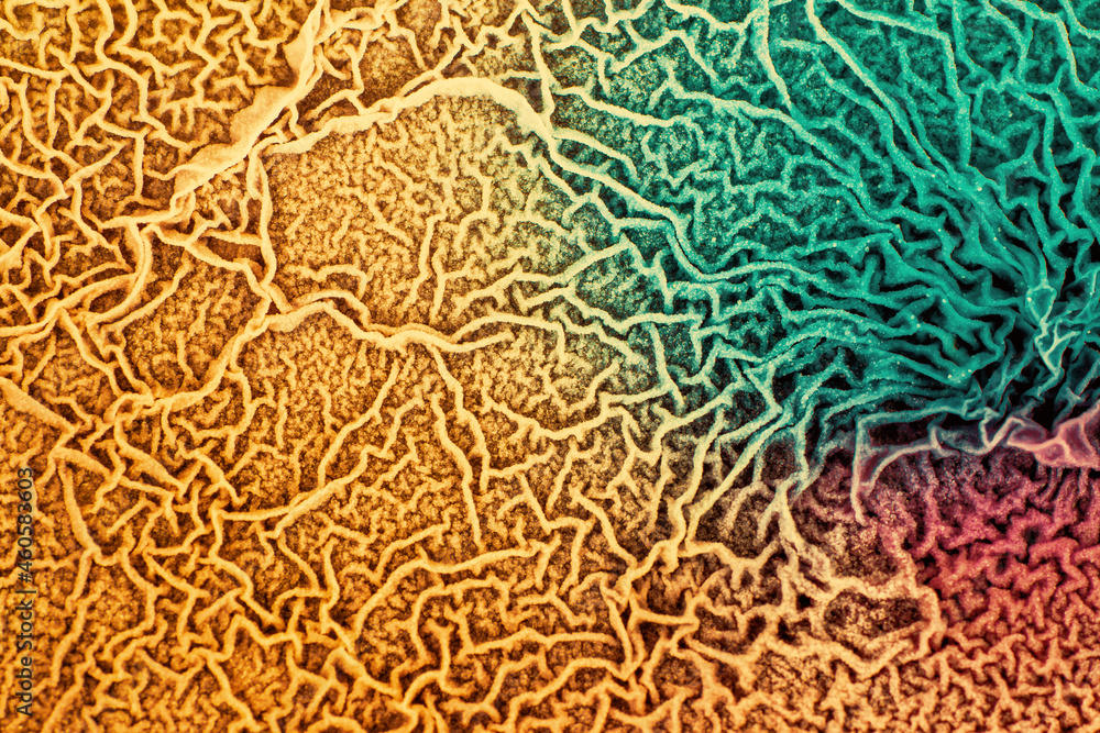 The tissue of a biological organism is affected by two types of cancer ...