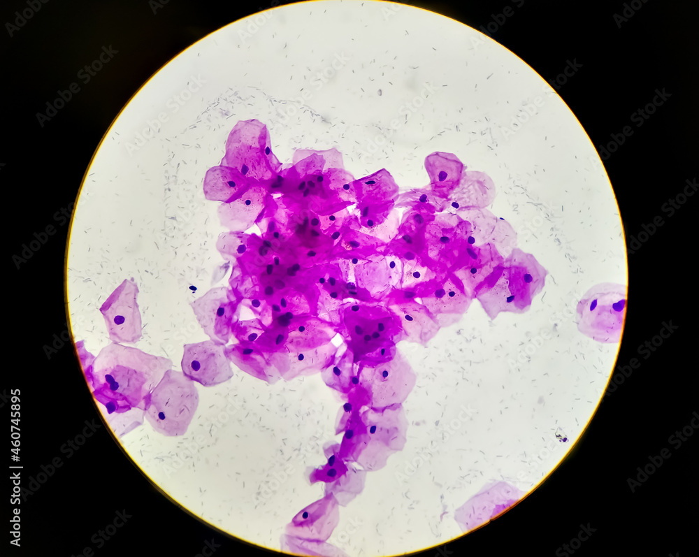 Microscopic view of normal human cervix cells. Squamous epithelial ...