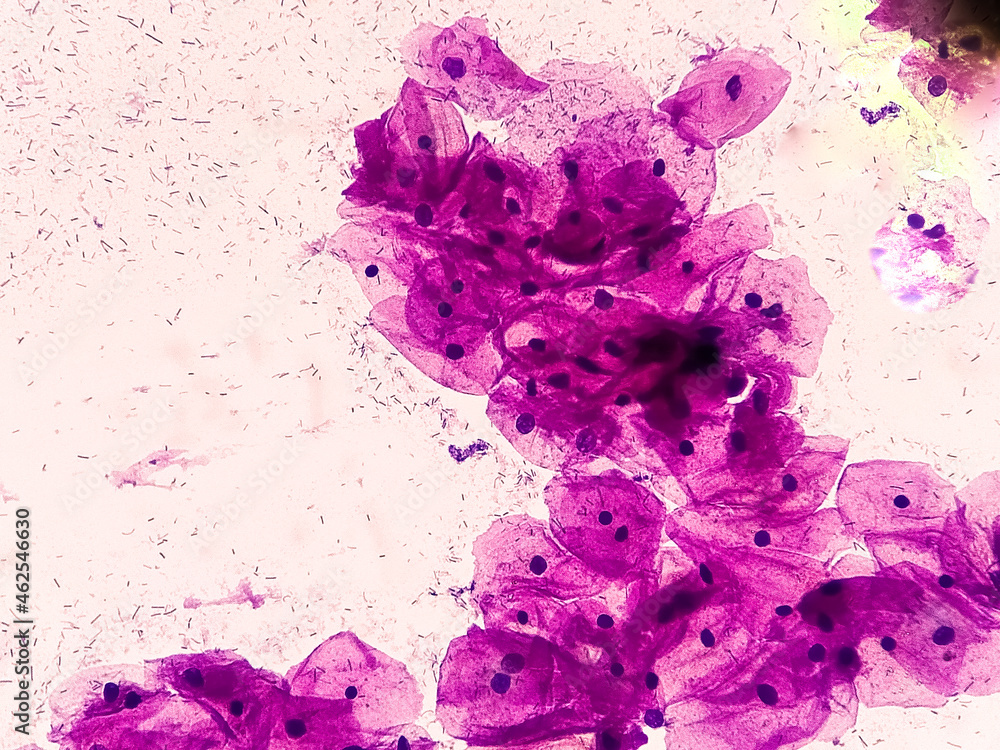 Foto de Stock Microscopic view of normal human cervix cells. Squamous ...