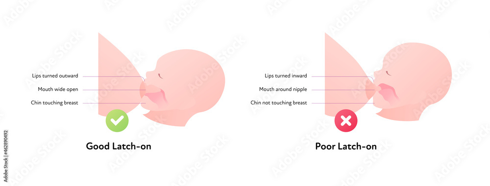 Breastfeeding infographic chart. Vector flat healthcare illustration ...