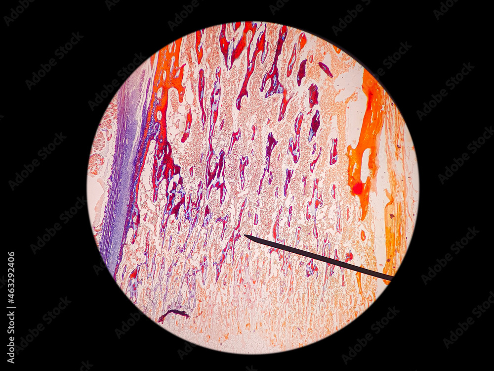 Foto Histology of radius (long bone) cross section 4X do Stock | Adobe ...