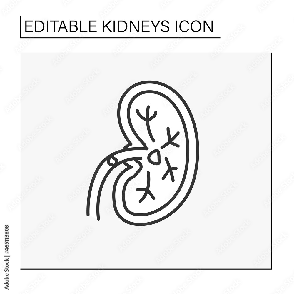Kidney line icon. Unhealthy internal organ.Kidney stones. Renal calculi ...