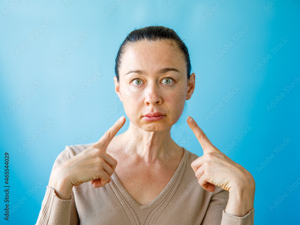 Stock-Foto „Teeth Problem. Gumboil, flux, bruise and swelling of cheek ...