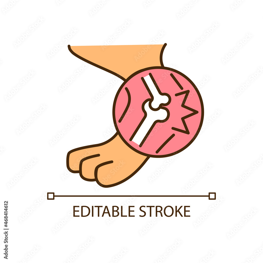 Vector de Stock Arthritis RGB color icon. Joints inflammation. Hips and ...