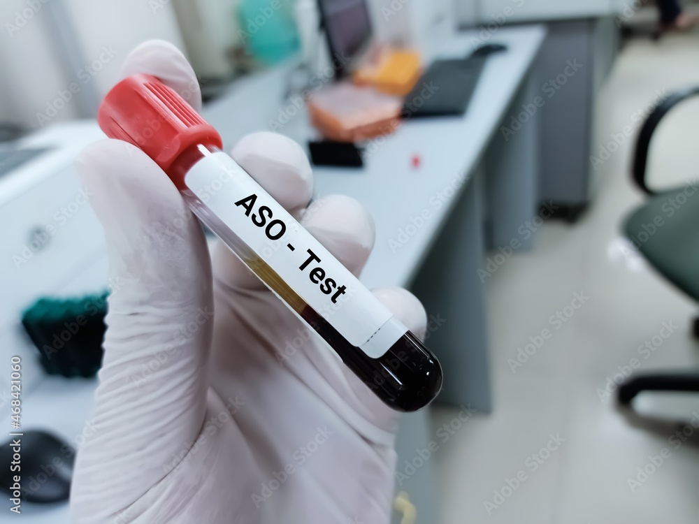 Blood sample for Antistreptolysin O (ASO) titer test. strep infection ...