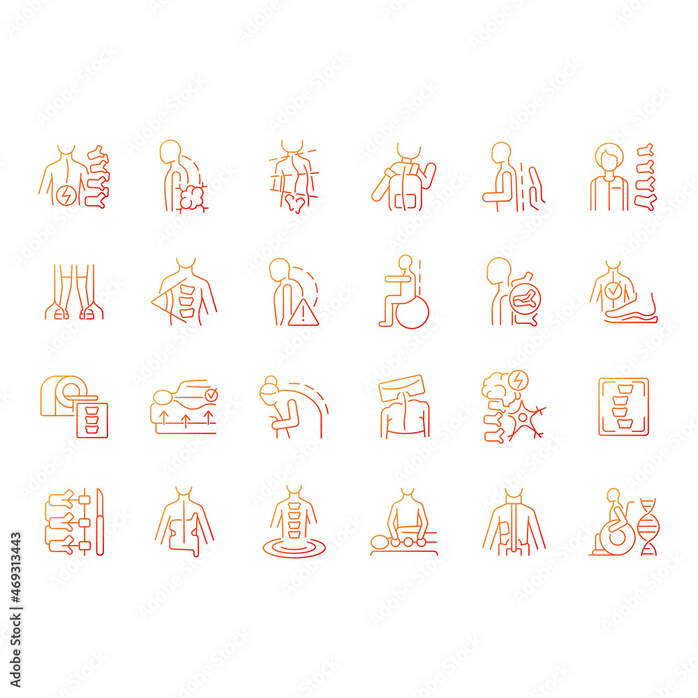 Scoliosis gradient linear vector icons set. Scoliosis stages and types ...