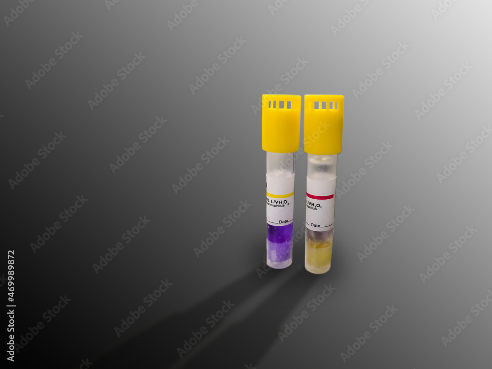 Two Positive And Negative Biological Indicators Of Hydrogen Peroxide ...