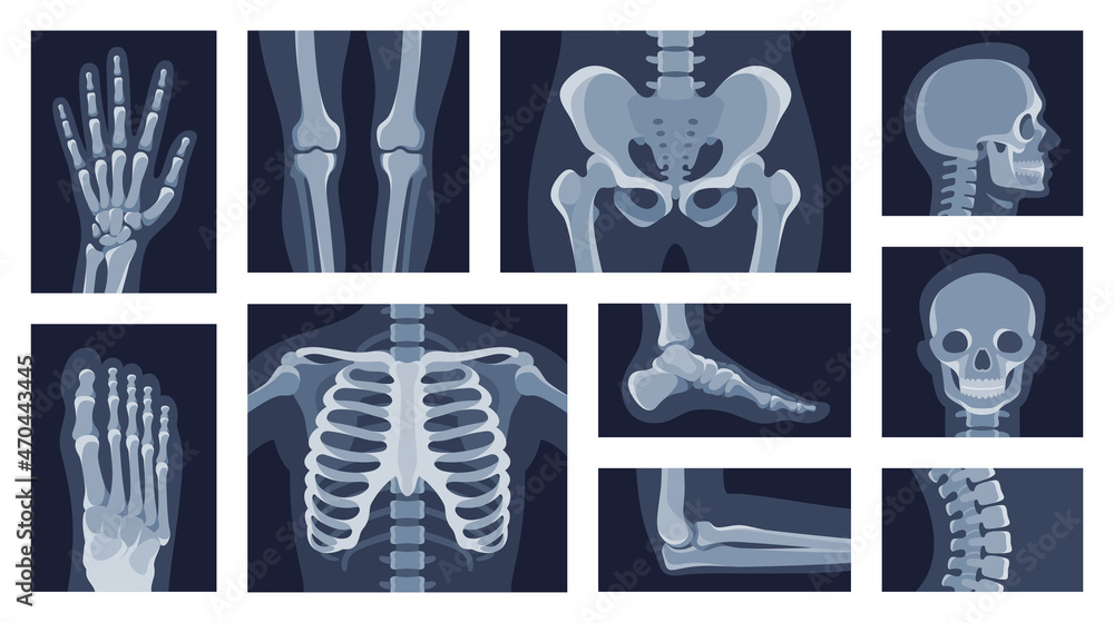 Collection different human body parts roentgen pictures vector flat ...
