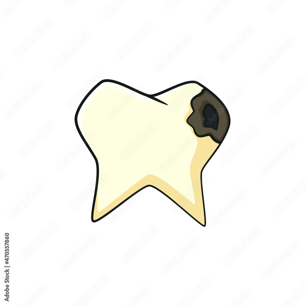Decayed tooth in drawing style isolated vector. Drawn object ...