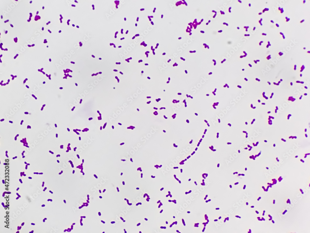 Bacteria Enterococcus isolated on white background micrograph. Gram ...