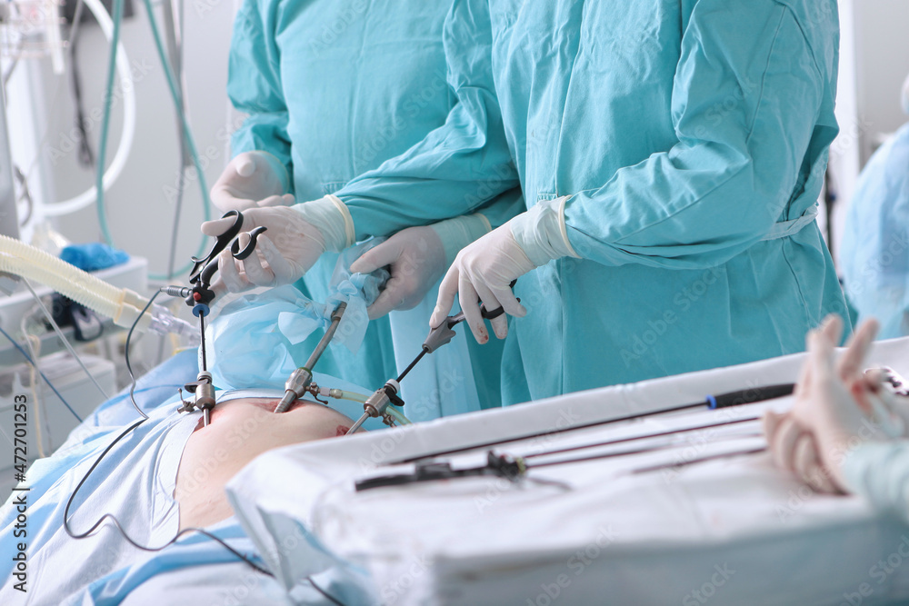 Laparoscopic surgery. Medical instruments in the hands of doctors ...