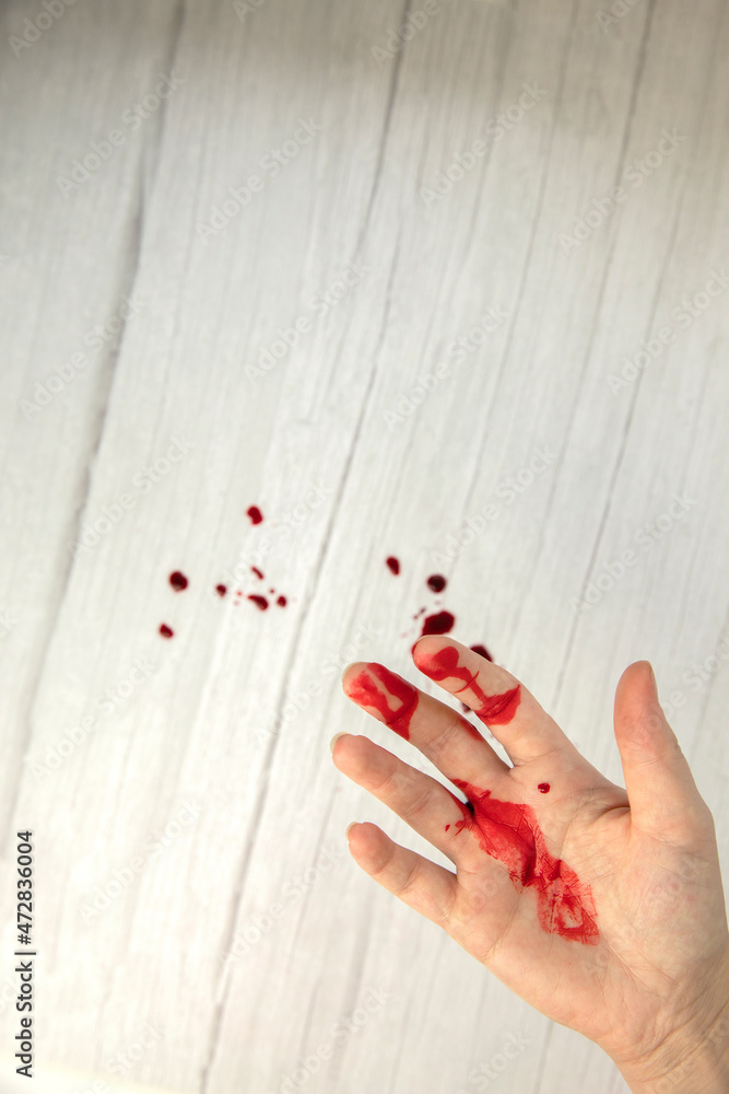 hand injury with blood, blood wound cut top view, copy space, medical ...