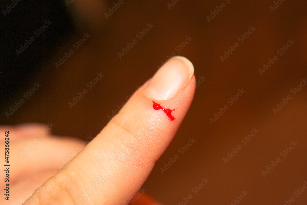 Blood protrudes from a small cut wound, maim on the index finger of a ...