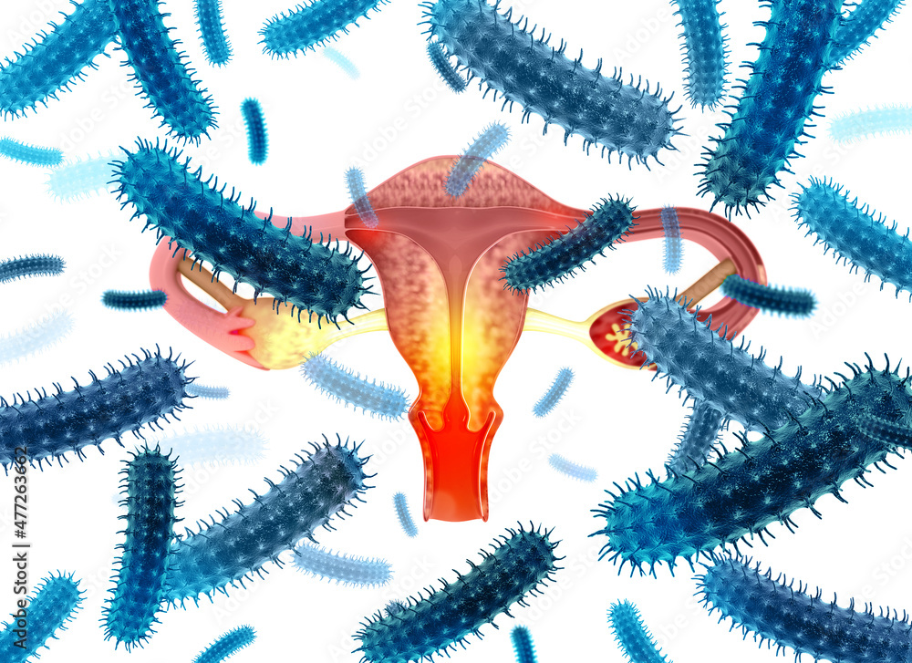 virus or bacteria infected female reproductive system. Uterine diseases ...
